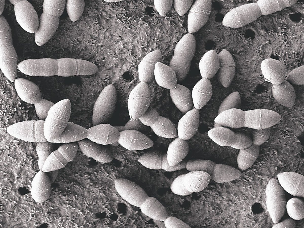 がん治療助ける腸内細菌 免疫細胞を活性化 がん研センター発表｜北日本新聞webunプラス