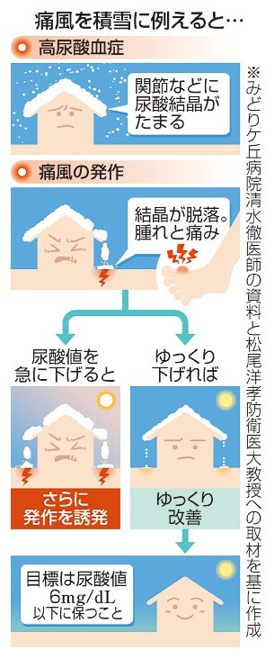 痛風はぜいたく病じゃありません 体質強く影響と判明｜北日本新聞webunプラス