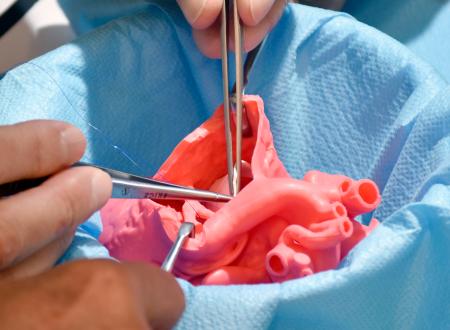 子どもの心臓3D模型に保険適用｜北日本新聞webunプラス